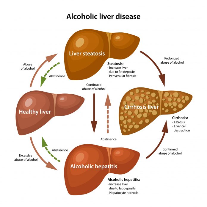 Love Life, Love Your Liver - Seniors Today